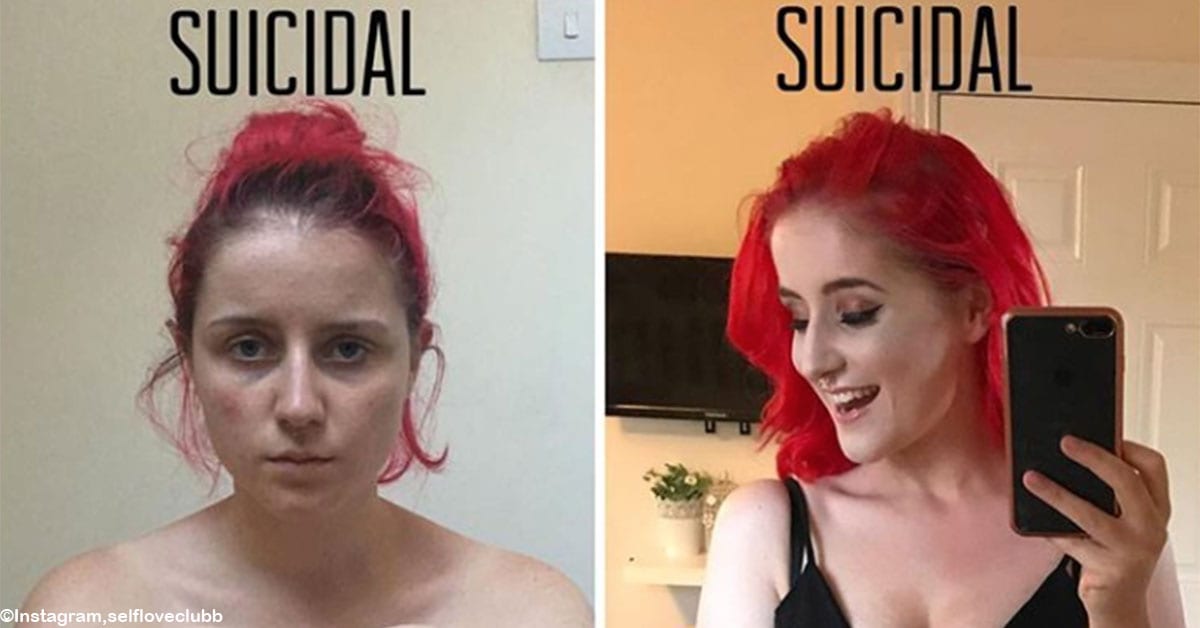 20 Photos That Show Depression Has No Face or Mood