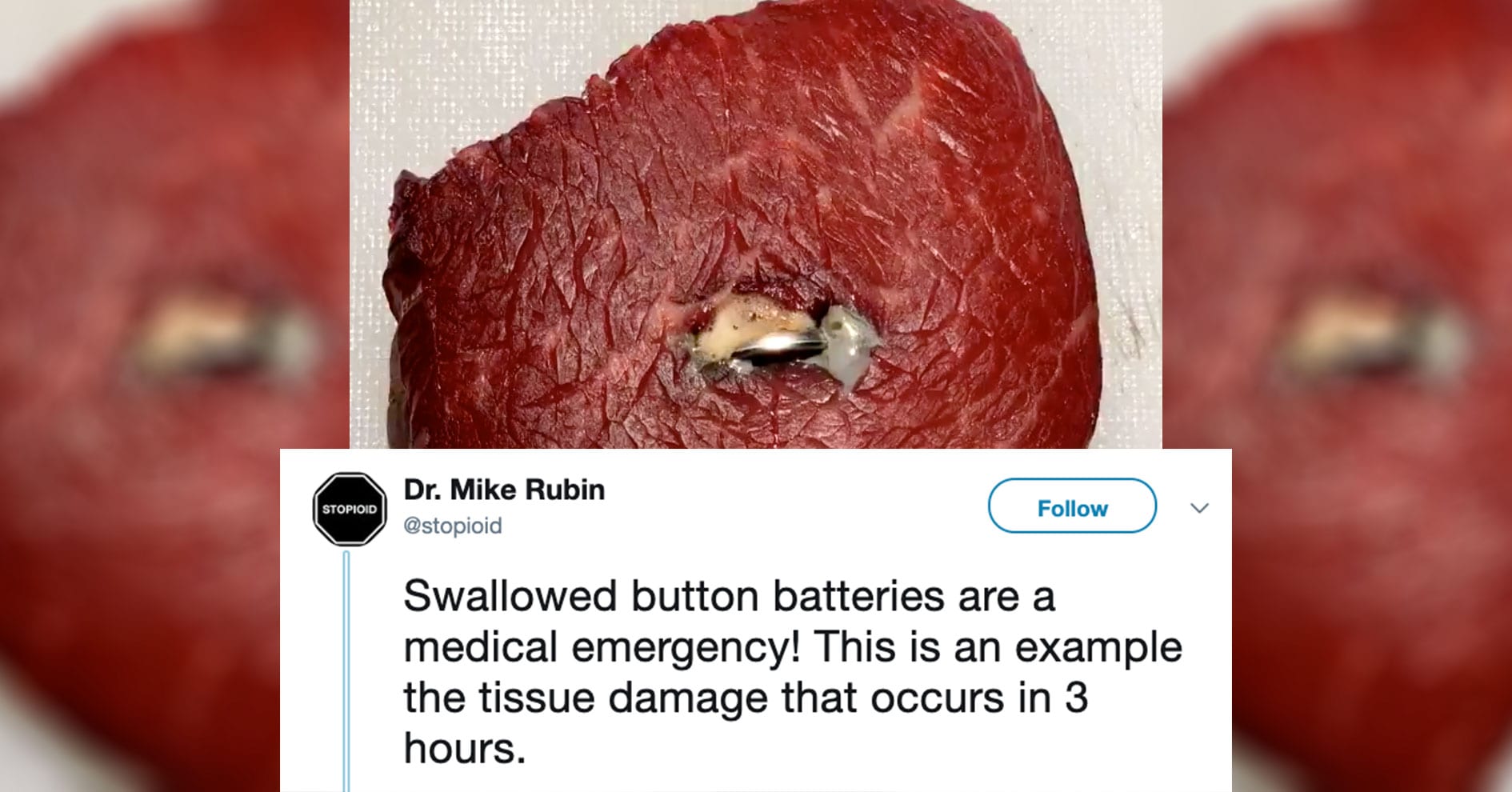 Video Shows How Quickly a Swallowed Battery Can Cause Tissue Damage