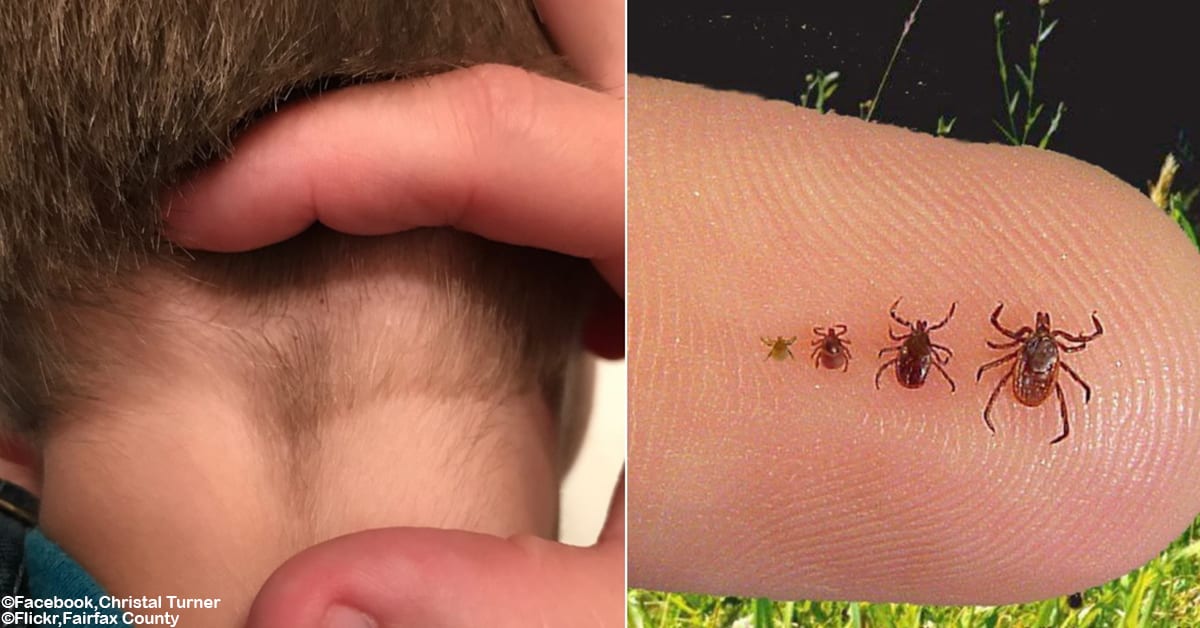 Mom's Viral Photos Show How Hard It Can Be to Spot Ticks on Kids