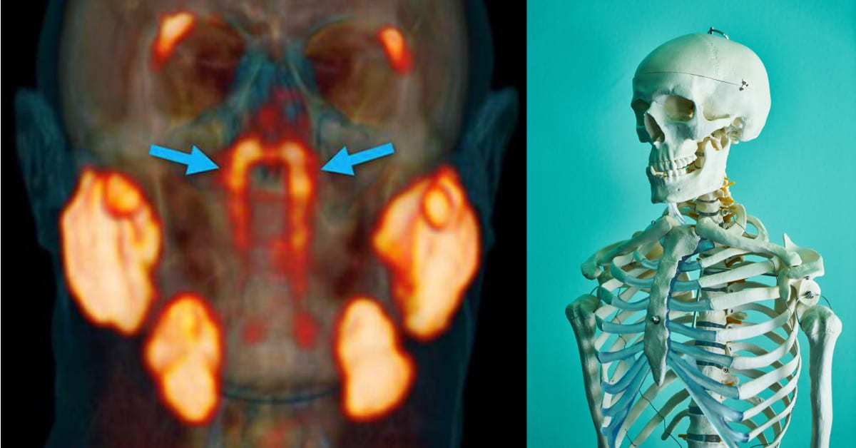 Doctors Just Discovered a New Organ Inside Our Heads by Accident